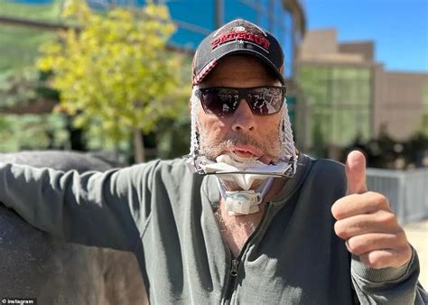 Montana Grandpa Whose Jaw Was Ripped Off By Bear Attacks Recovery
