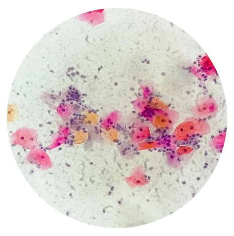 Premium Photo Pap039s Smear Atrophic Post Menopausal Smear Containing