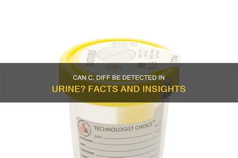 Can C Diff Be Detected In Urine Facts And Insights Medshun