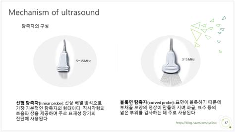 근골격계 초음파 검사 제대로 알자 3 초음파의 원리 탐촉자 Probe 초음파 화면 조절 네이버 블로그