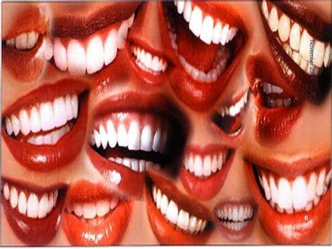 Fresh Socket Implant Placement Pptx