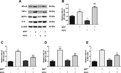 The Effect Of Of Pdtc On Cytokines Expression A E Nf κb Specific Download Scientific Diagram
