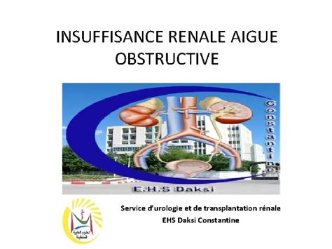 Insuffisance Renale Aigue Obstructive Service Durologie Et De