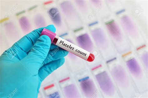 Platelet Count Test PrognoHealth Corporate Health Wellness Specialist