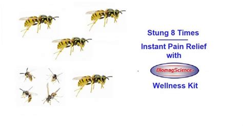 Can Yellow Jacket Stings Cause Cellulitis At Henry Christie Blog