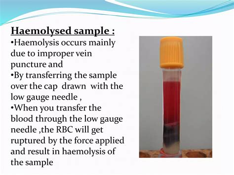 Phlebotomy And Pre Analytical Error Pptpptx
