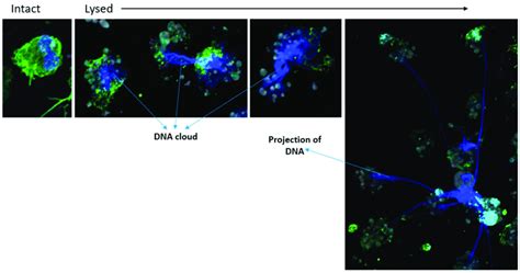 Il3 Primed Eosinophils On Igg Release Dna In The Extracellular