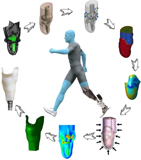 Prosthetic Socket Design Gibboncode