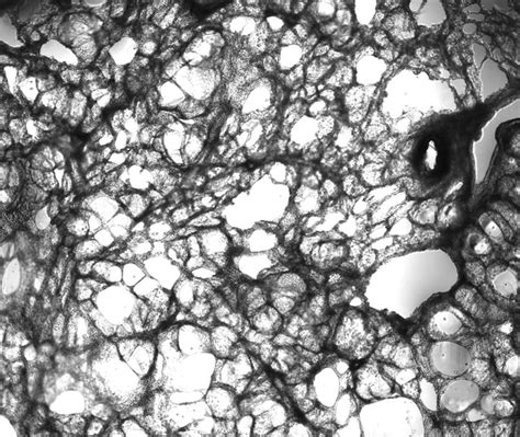 Human Precision Cut Lung Slice Pcls 001f 28 Male Hispanic Cell Systems