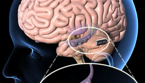Hippocampal Prosthesis Outreach1