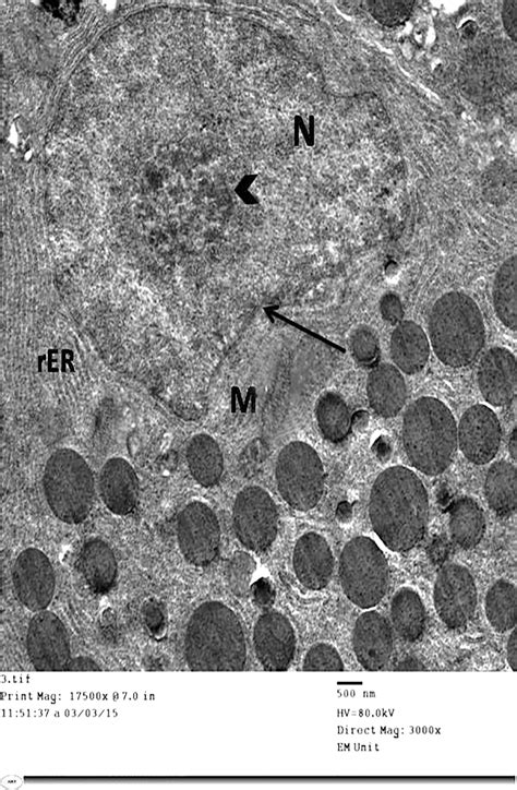 An Electron Micrograph Of An Ultrathin From The Exocrine Part Of The