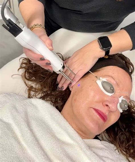 Pico Genesis Revive At The Group Med Spa Pico Genesis Revive At The Group Med Spa