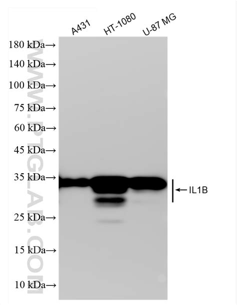 Il 1 Beta Antibody 82696 15 Rr Proteintech