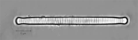 Phycokey Diatoma Images