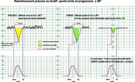 Classification Rcf E Rcf
