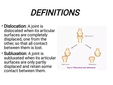 Dislocation And Sublaxation Pdf