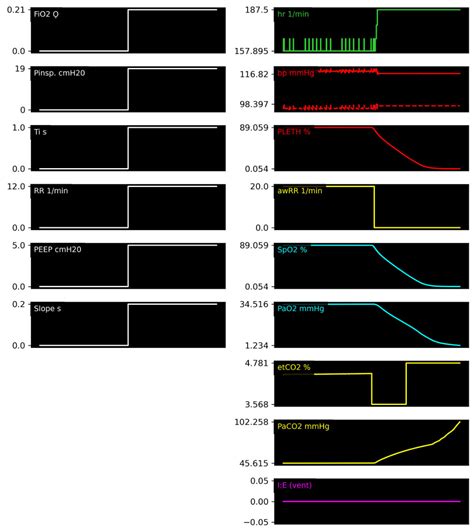 Simple Ventilator Not Improving Patients Health For Ards Pulse