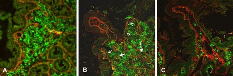 Panel A Detection Of Anti Tissue Transglutaminase 2 Anti Tg2 Iga