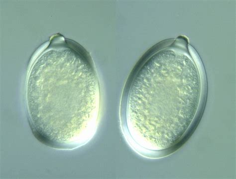 Protist Images Nassula