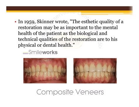 Composite Resins Ppt Composite Resins Ppt