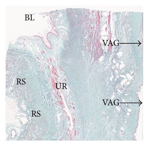 Sagittal Sections In A 91 Year Old Man And An 88 Year Old Woman Panel