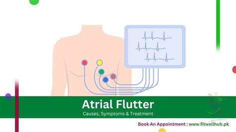 Atrial Flutter Symptoms Causes And Treatment Guide