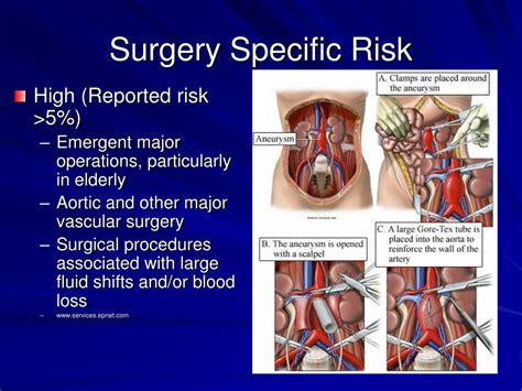 Surgical Risk Procedure Type Classification Of Surgery According To