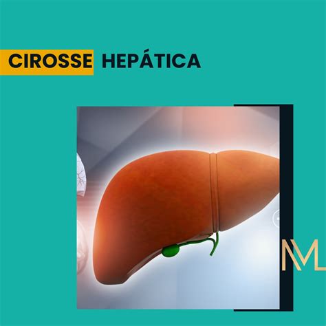 Cirrose Alcoolica Estágios De Dano Hepático Não Alcoólico