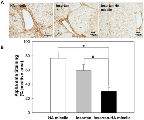 Immunohistochemical Analysis Of α Sma Expression In Liver Section A