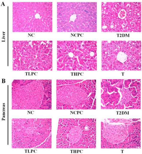 Phycocyanin Protects Against High Glucose High Fat Diet Induced