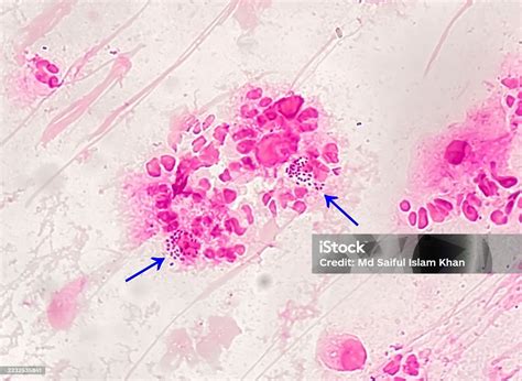 Neisseria Gonorrhoeae Is A Species Of Gramnegative Diplococci Bacteria