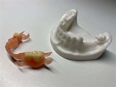 Replace Your Missing Teeth At Home Resetsmile Missing Teeth Teeth