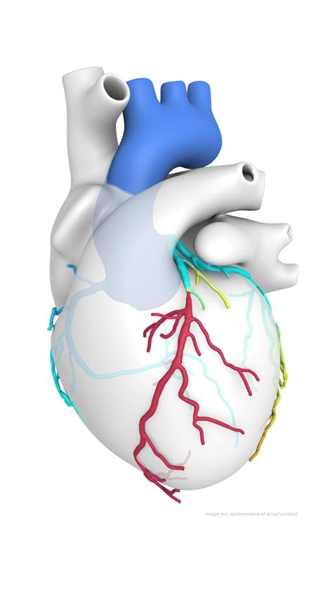 Heartflow Analysis Improving Patient Care And Saving Millions Of