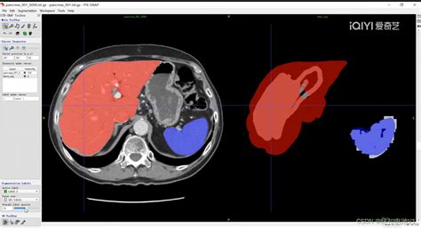 itksnap使用学习 itksnap crosshair csdn博客