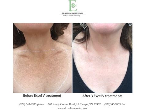 Melissa Kainer Erwin Updated January 2026 203 Sandy Corner Rd El Campo Texas