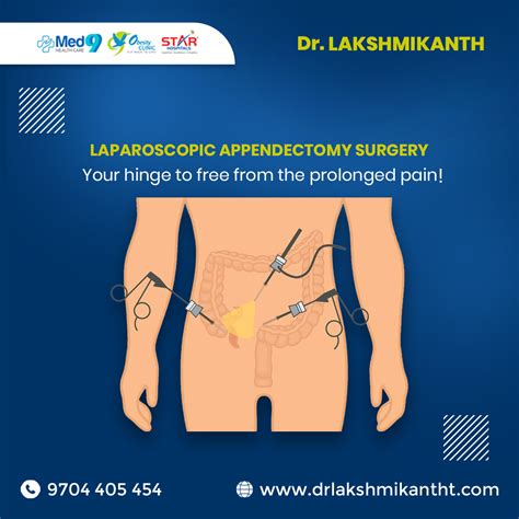 Laparoscopic Appendectomy Surgery Is The Process That Involves No Pain