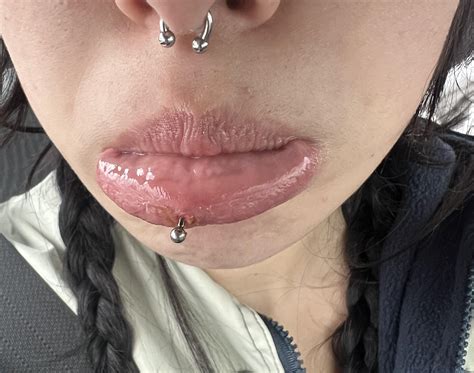 Vertical Labret Piercing Infection Mat Pierced This Vertical Labret Vertical Labret Piercing Infection Mat Pierced This Vertical Labret