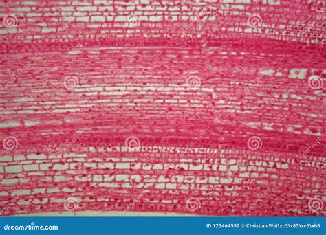 Longitudinal Section Through Cells Of A Root From A Maize Plant Under