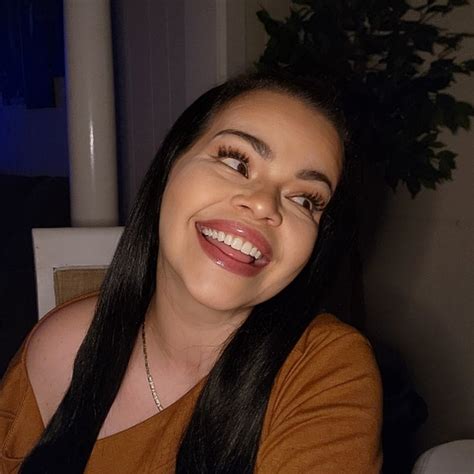 2 Years Ago Abcess Above My Front Teeth Rdentures