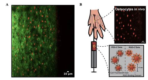 Karl Lewis On Linkedin Check Out Our New Article In Bone Novel