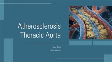 Atherosclerosis Thoracic Aorta Ppt Mockup Acp Ppt Template