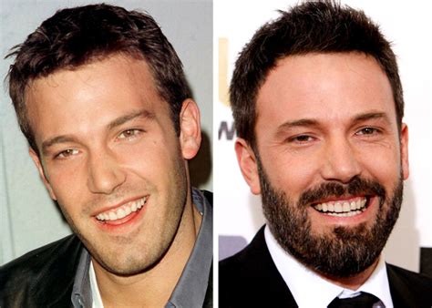 18 Times Celebrities Impressed Us With Their New Teeth