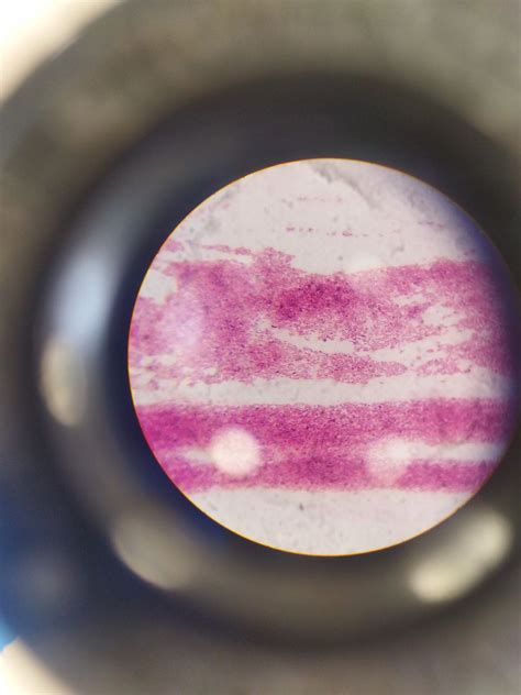 Schaaliaactinomyces Turicensis Facultative Anaerobe Bacteria That Was Isolated From Vulvar