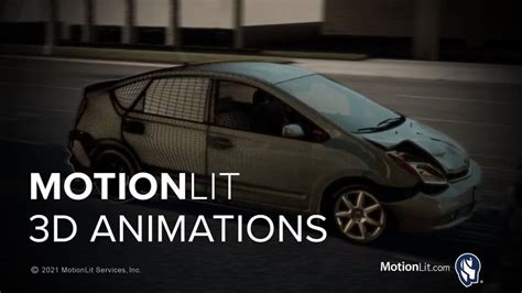 Animation Exhibits Complex Radius And Ulna Orif Procedure Motionlit