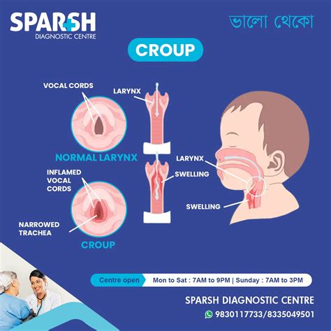 Croup Sparsh Diagnostic Center