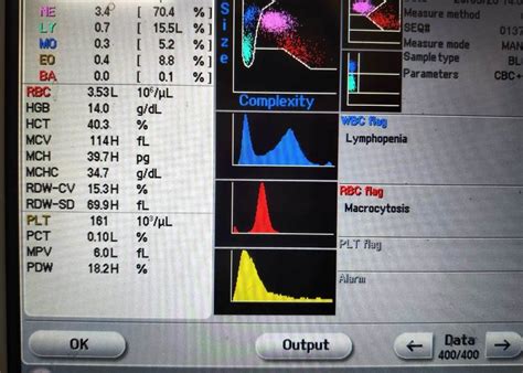 Microcytosis Shift To Left Download Scientific Diagram