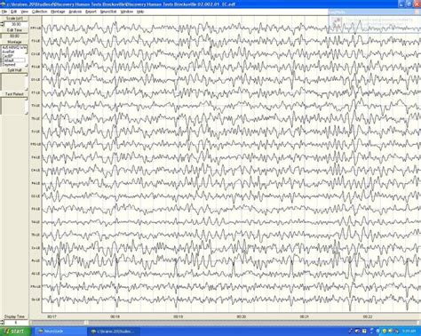 The First Brain And The Second Brain Part 1 The First Brain And The