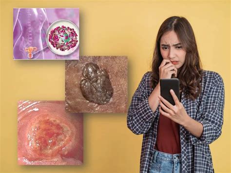 Blue Waffle Disease Medical Experts Debunk This Viral Internet Myth