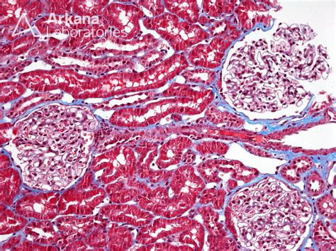 Normal Renal Cortex On Trichrome2 Ismms Nephrology Fellowship
