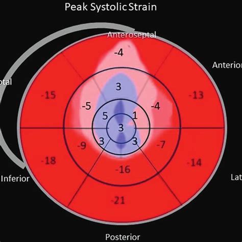 Global Longitudinal Strain Plot On Transthoracic Echocardiography With Download Scientific